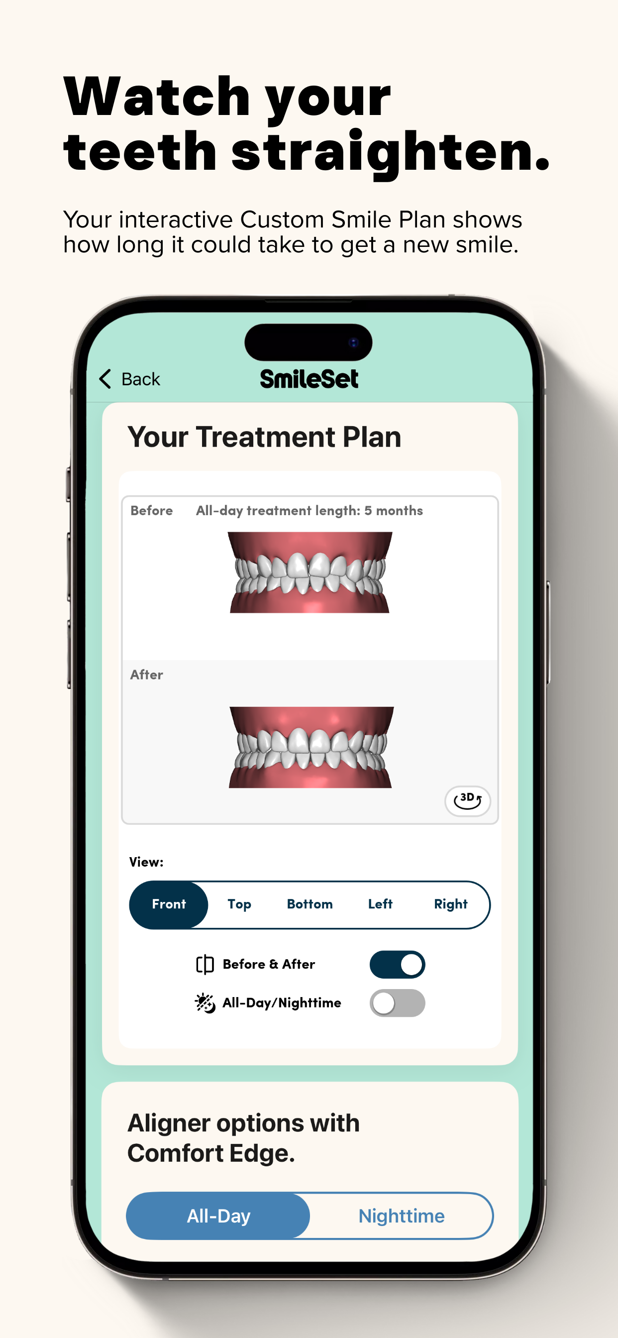 SmileSet App