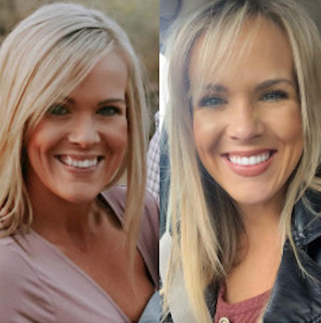 Why Smile Set? – SmileSet